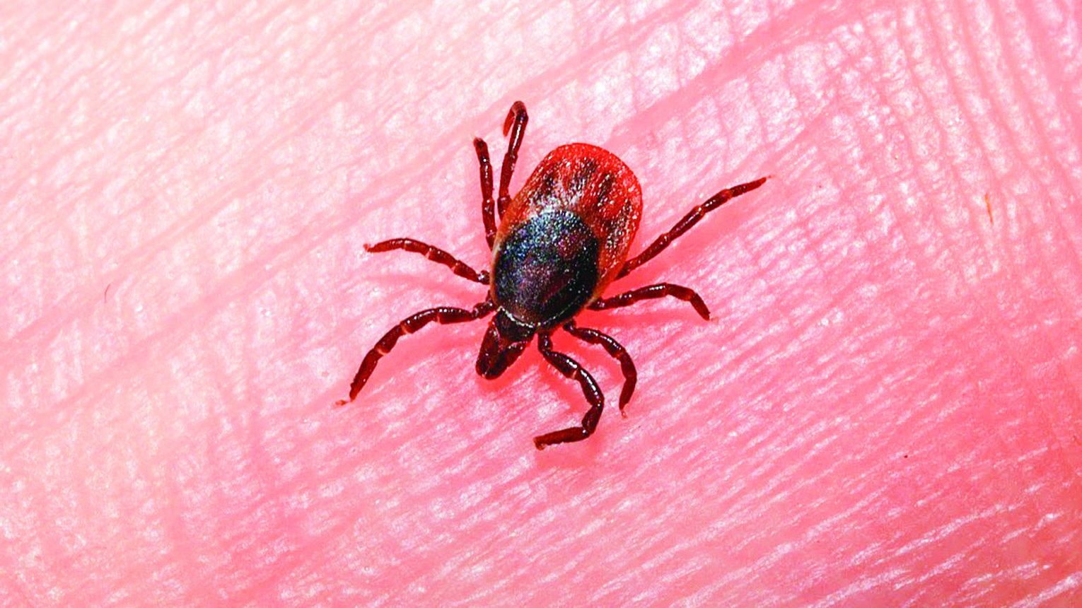 Ticks drive jump in Lyme disease